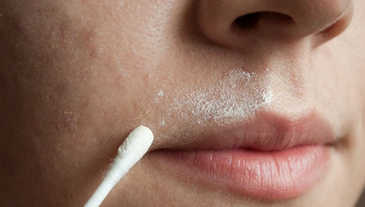 10 DIY Facial Hair Removal Techniques (That Don’t Involving Shaving or ...