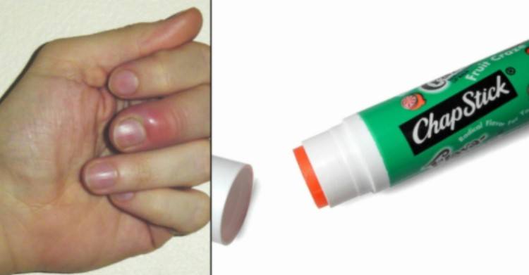13 Completely Unexpected Ways to Use ChapStick